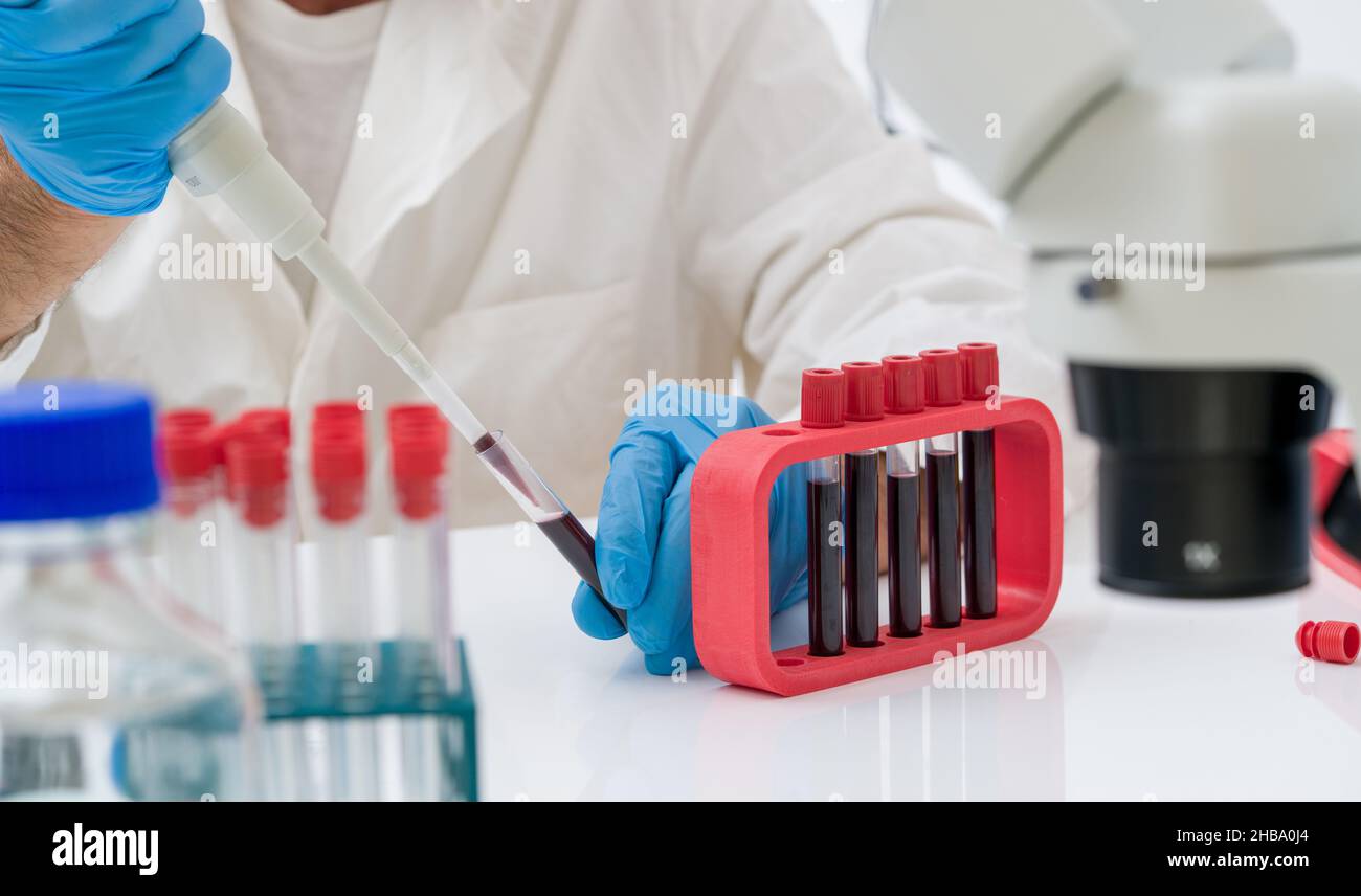 Preparation blood samples in hi-res stock photography and images - Alamy
