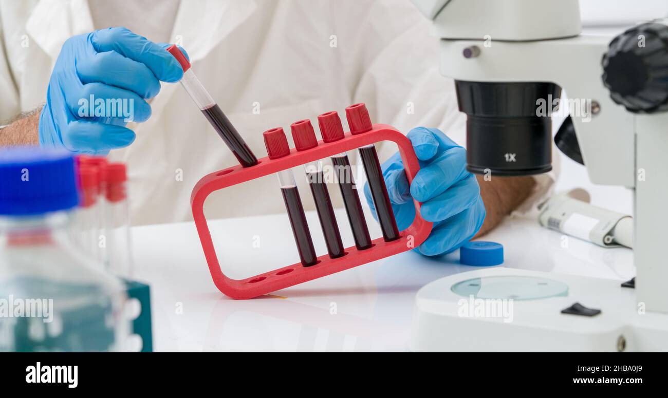 Preparation blood samples in hi-res stock photography and images - Alamy