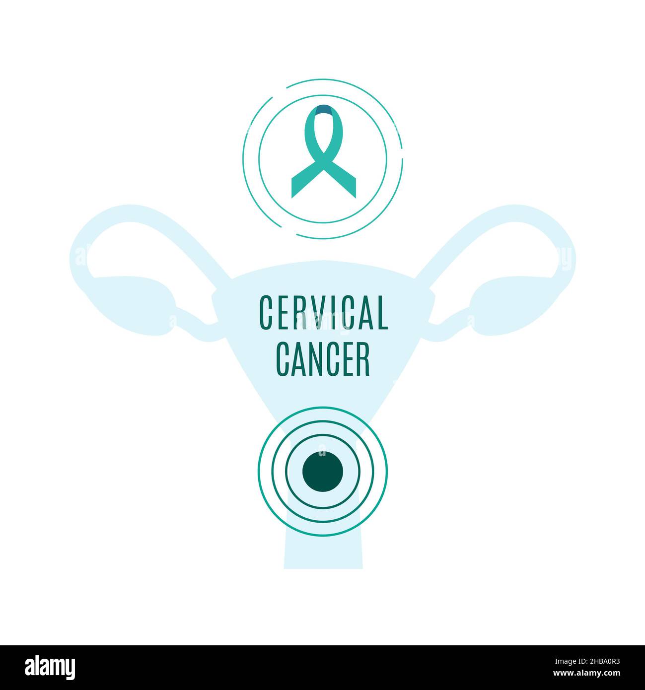 Cervical cancer awareness ribbon, conceptual illustration Stock Photo ...
