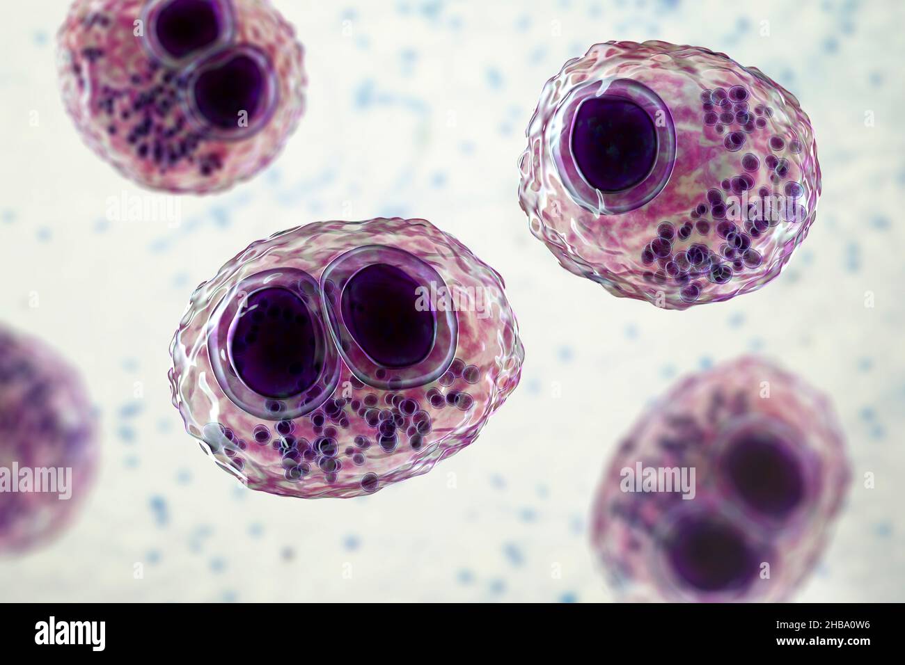 Human cytomegaloviruses (HCMV) in a cell producing 'owl's eye ...