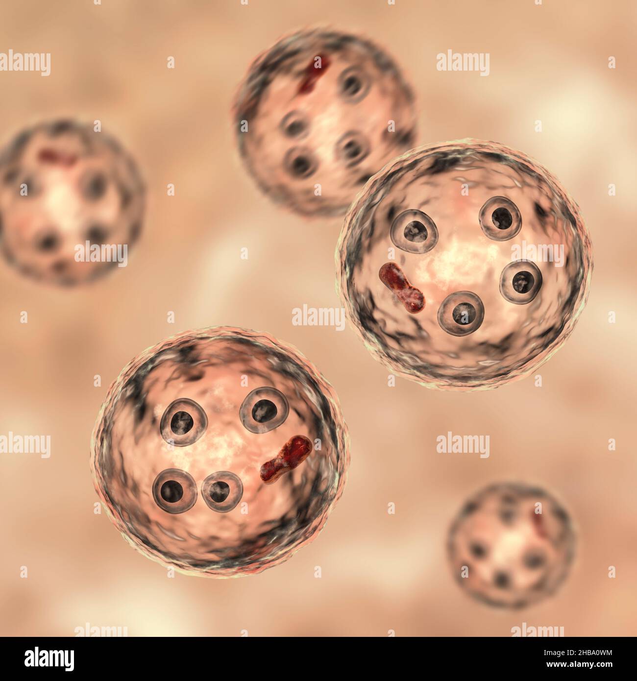 Cysts of Entamoeba histolytica protozoan, computer illustration ...