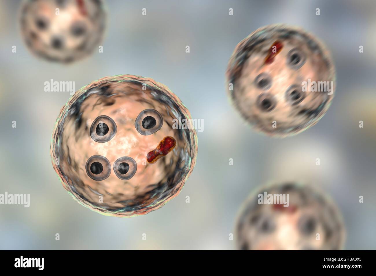 Cysts of Entamoeba histolytica protozoan, computer illustration ...