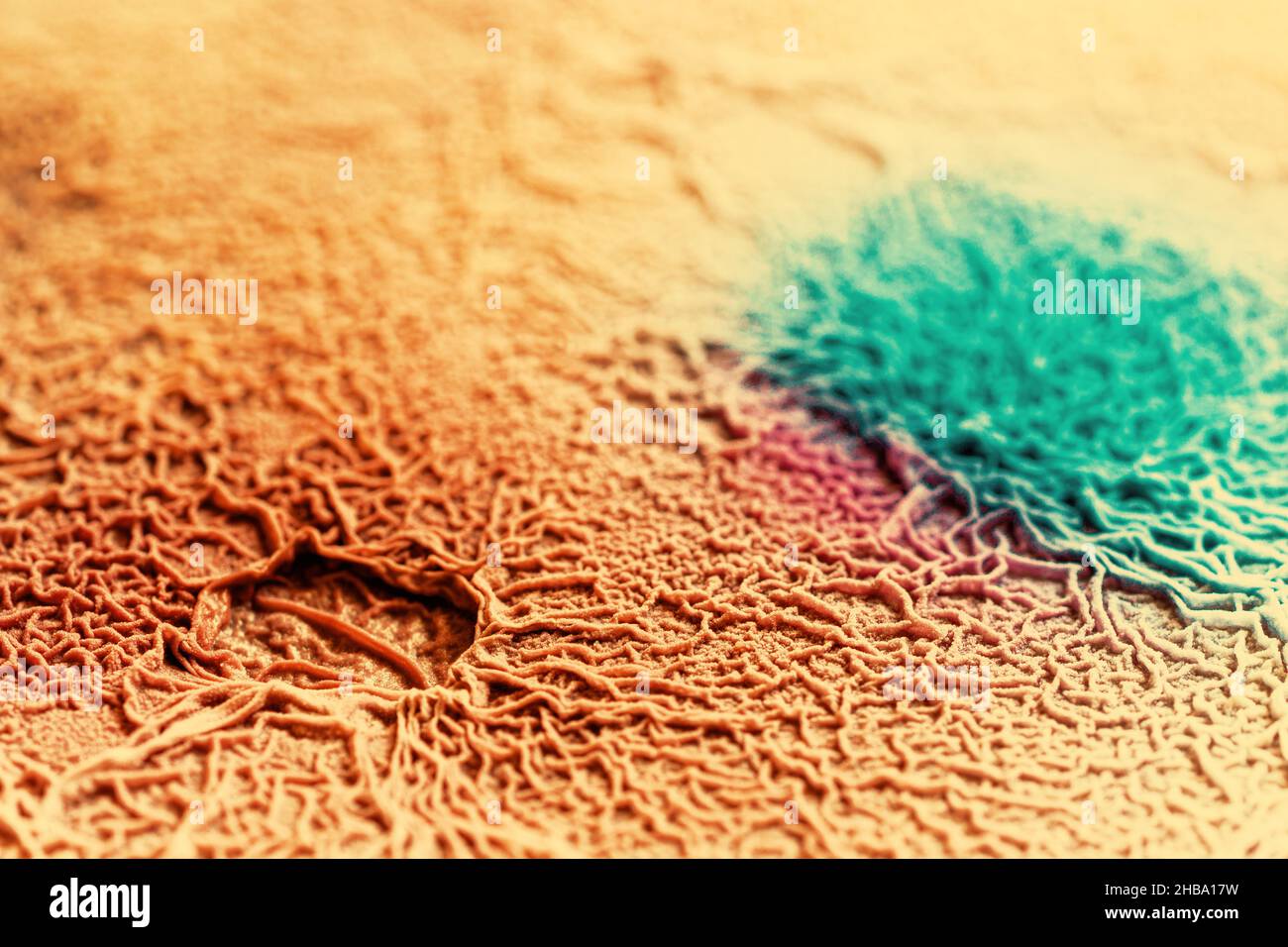 Biological tissue infected with pathogenic microorganisms Stock Photo ...