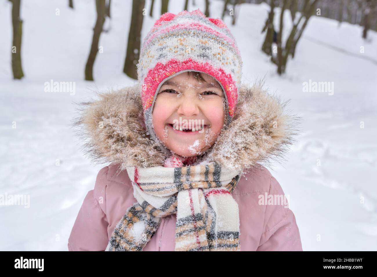 Toothless girl hi-res stock photography and images - Alamy