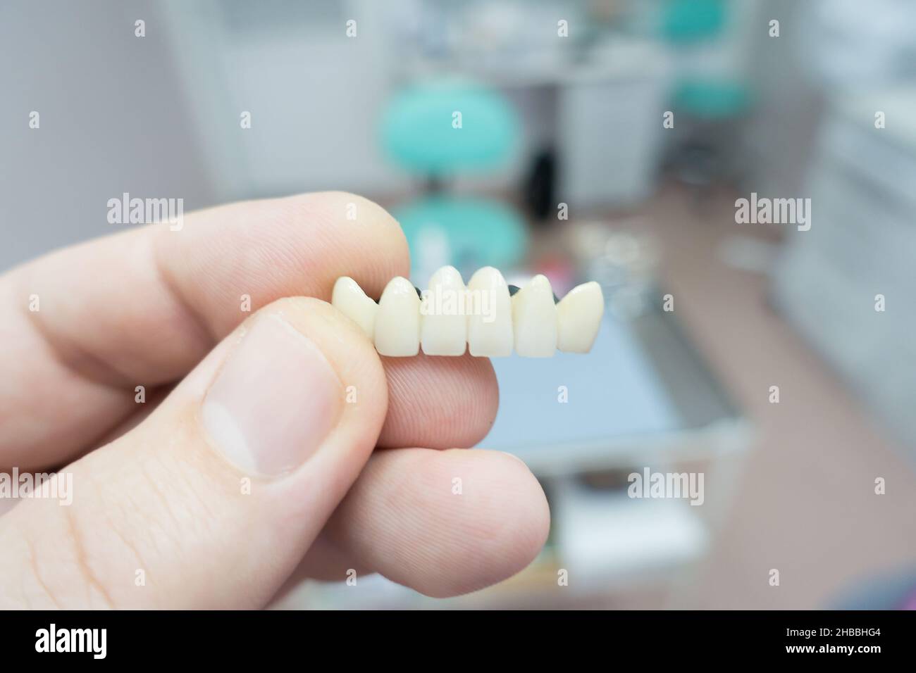 Ceramic metal bridges on hi-res stock photography and images - Alamy