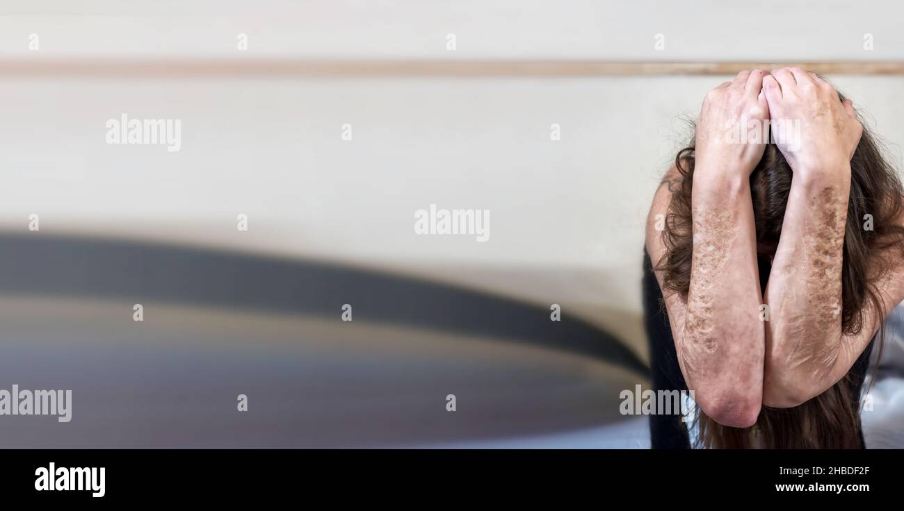 Borderline personality disorder hi-res stock photography and images - Alamy