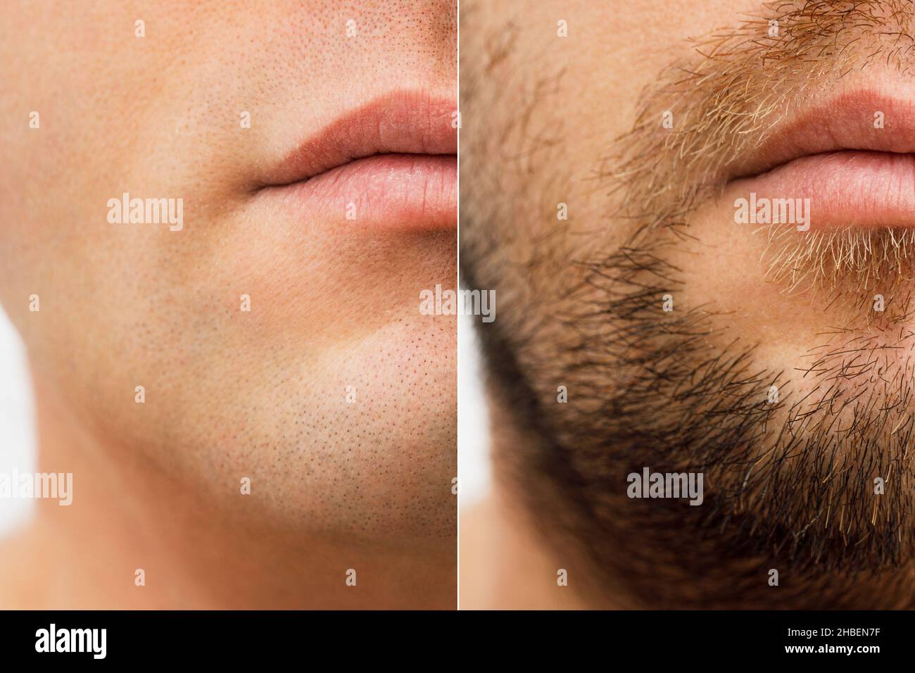 A close-up photo of a man's face without a beard and with a beard Stock ...