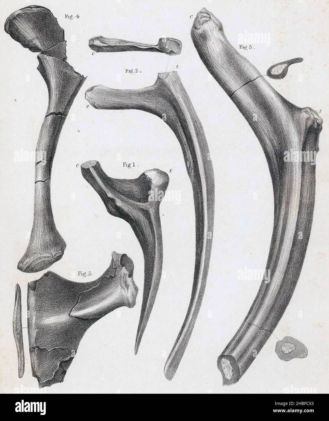 Ribs and pelvic elements. The left rib fragment shows a healed fracture ...