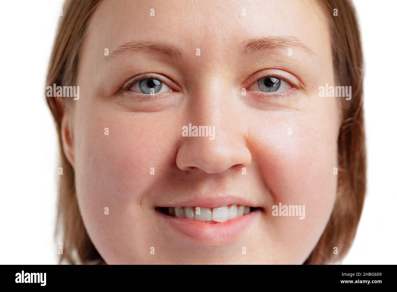 Skin whitening ads hi-res stock photography and images - Alamy