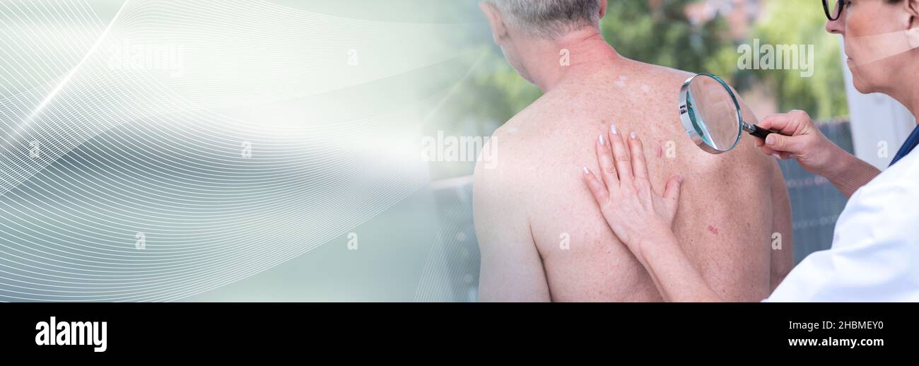 Dermatologist examining the skin on the back of a patient. panoramic ...