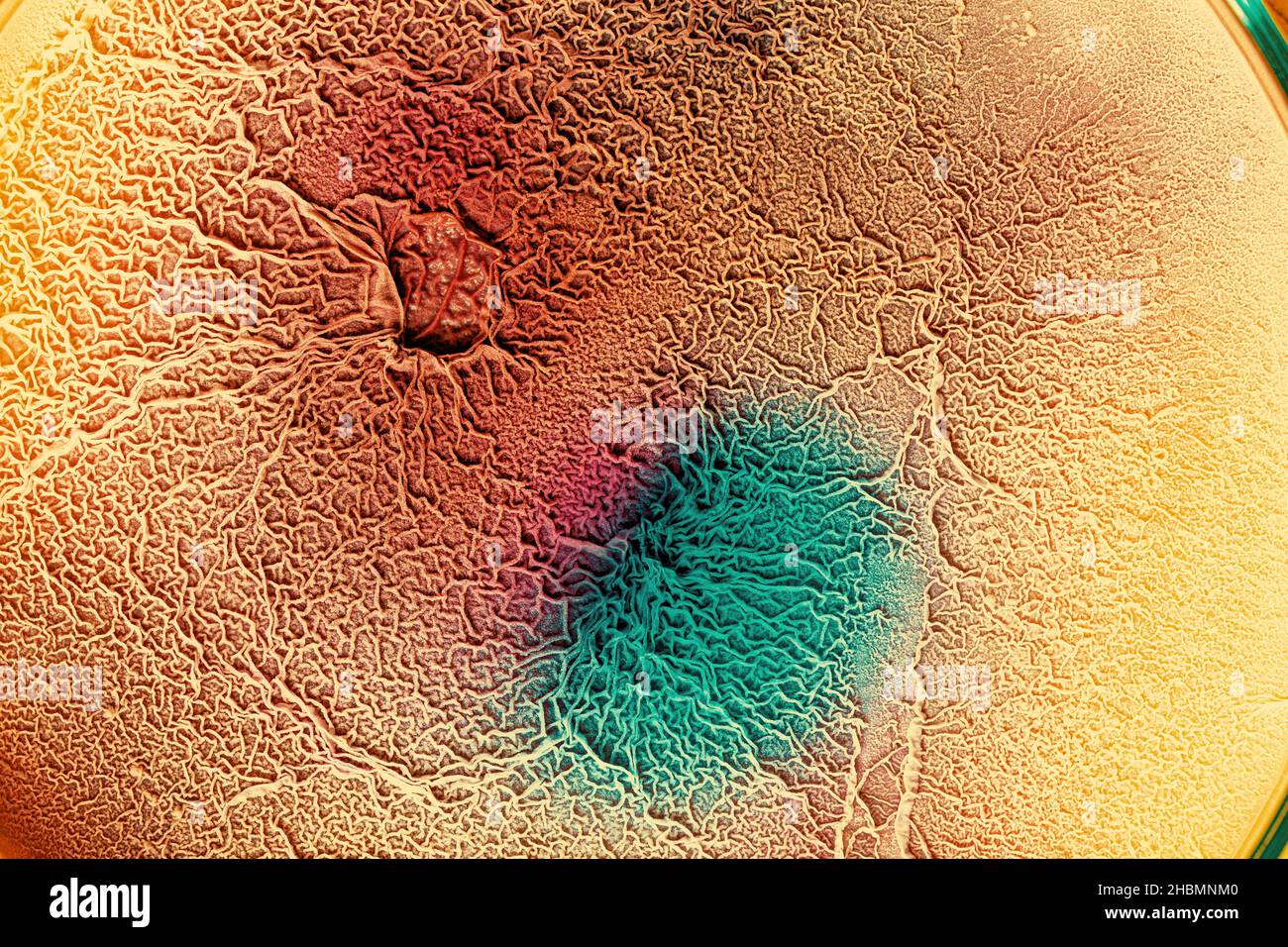 The tissue of a biological organism is affected by two types of cancer ...