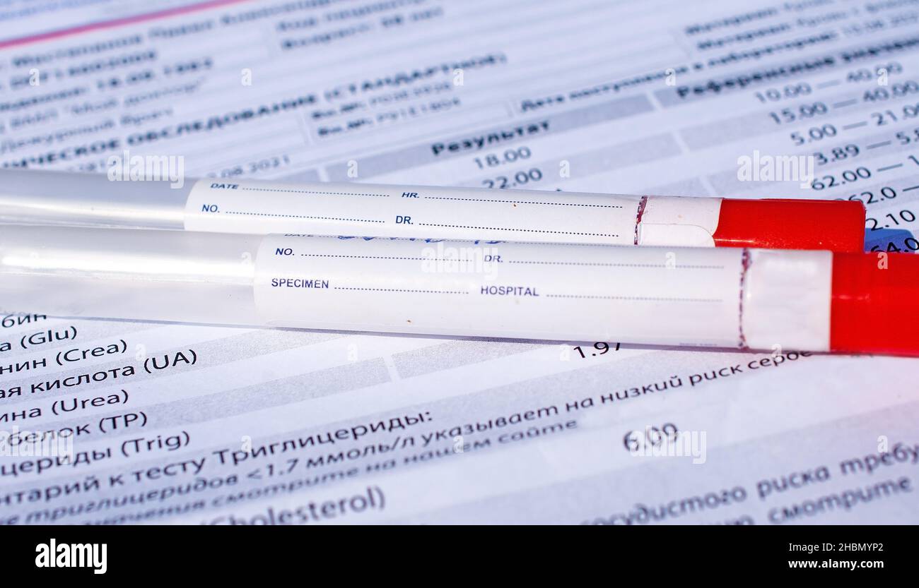 Test tubes and results of biochemical tests for viruses Stock Photo - Alamy