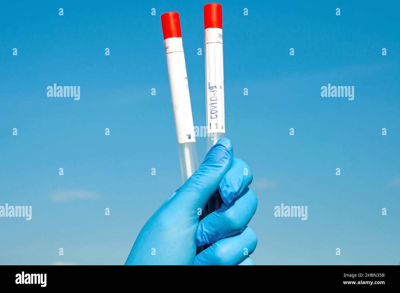 Biochemical tests bacteria hi-res stock photography and images - Alamy