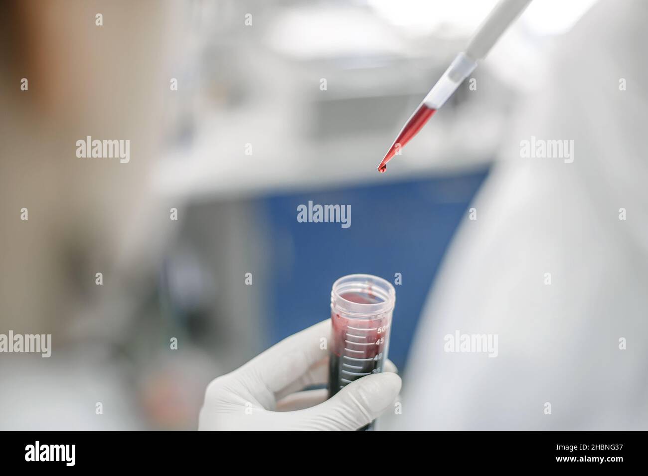 Medical laboratory scientists in the laboratory filling test tubes with ...