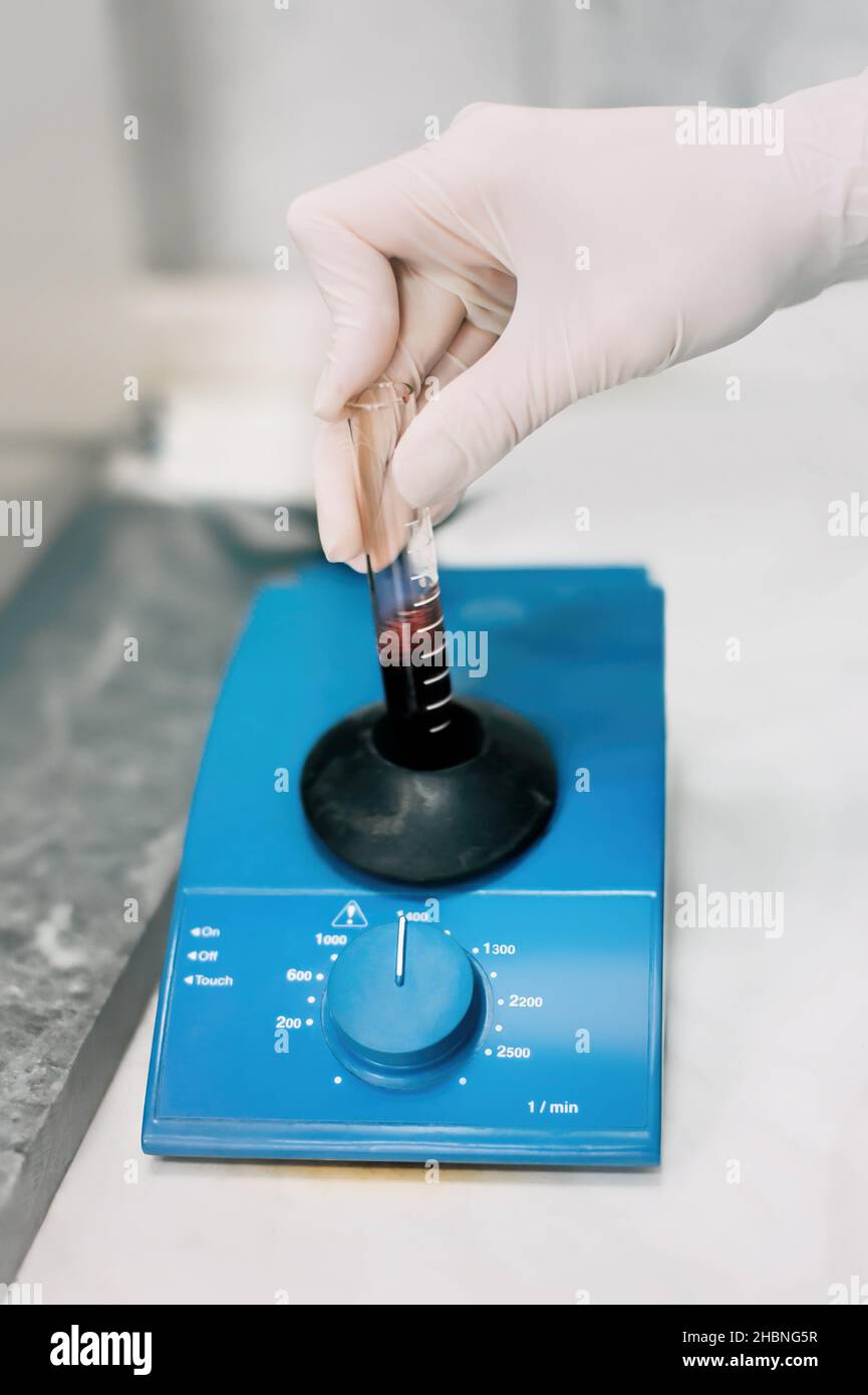 Clinical chemistry analyzer hi-res stock photography and images - Alamy
