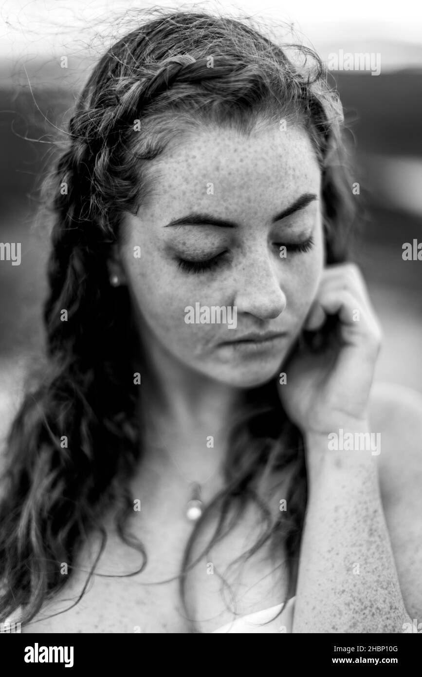 White freckles hi-res stock photography and images - Alamy