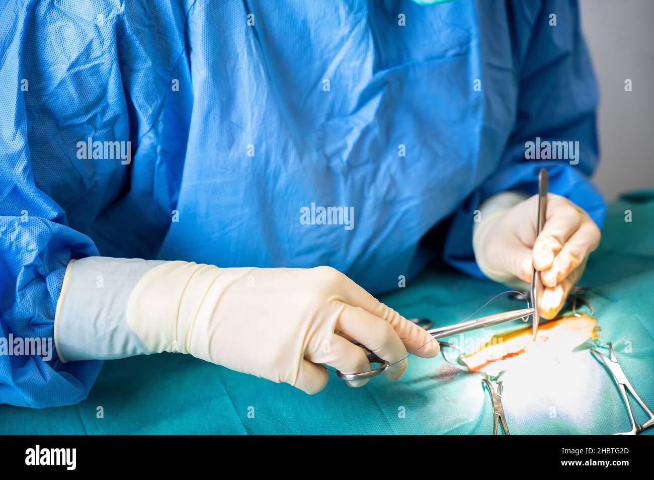 Surgery operation. Close up of surgeon hands stitching the wound after ...