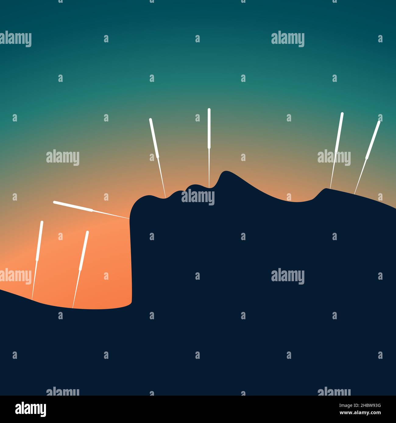 Acupuncture banner with woman face silhouette and chinese needles ...