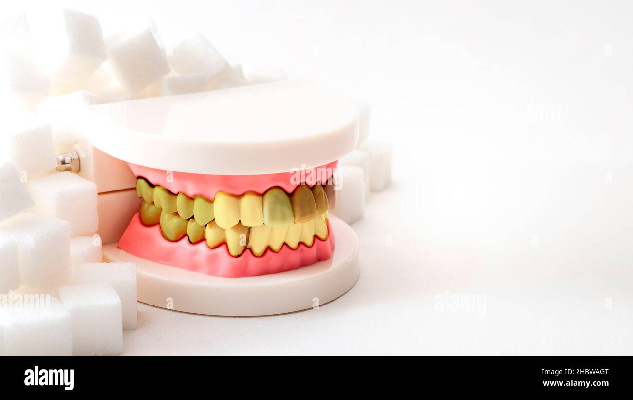 Oral health, tooth decay and cavities and sugary foods destroy the ...