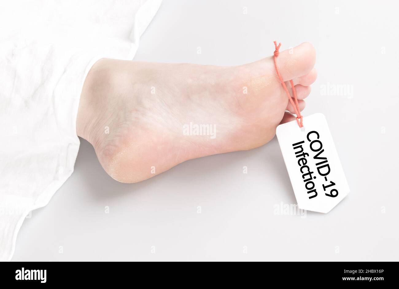 Body with toe tag on white, under a white sheet - Covid-19 infection ...