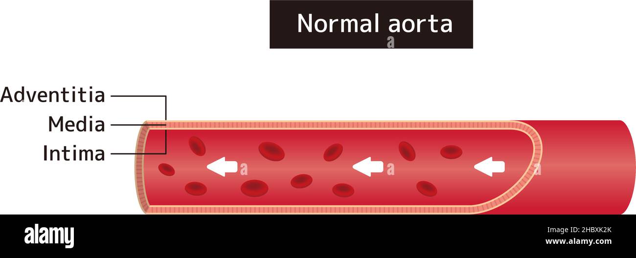 Vestor illustration of normal aorta Stock Vector Image & Art - Alamy
