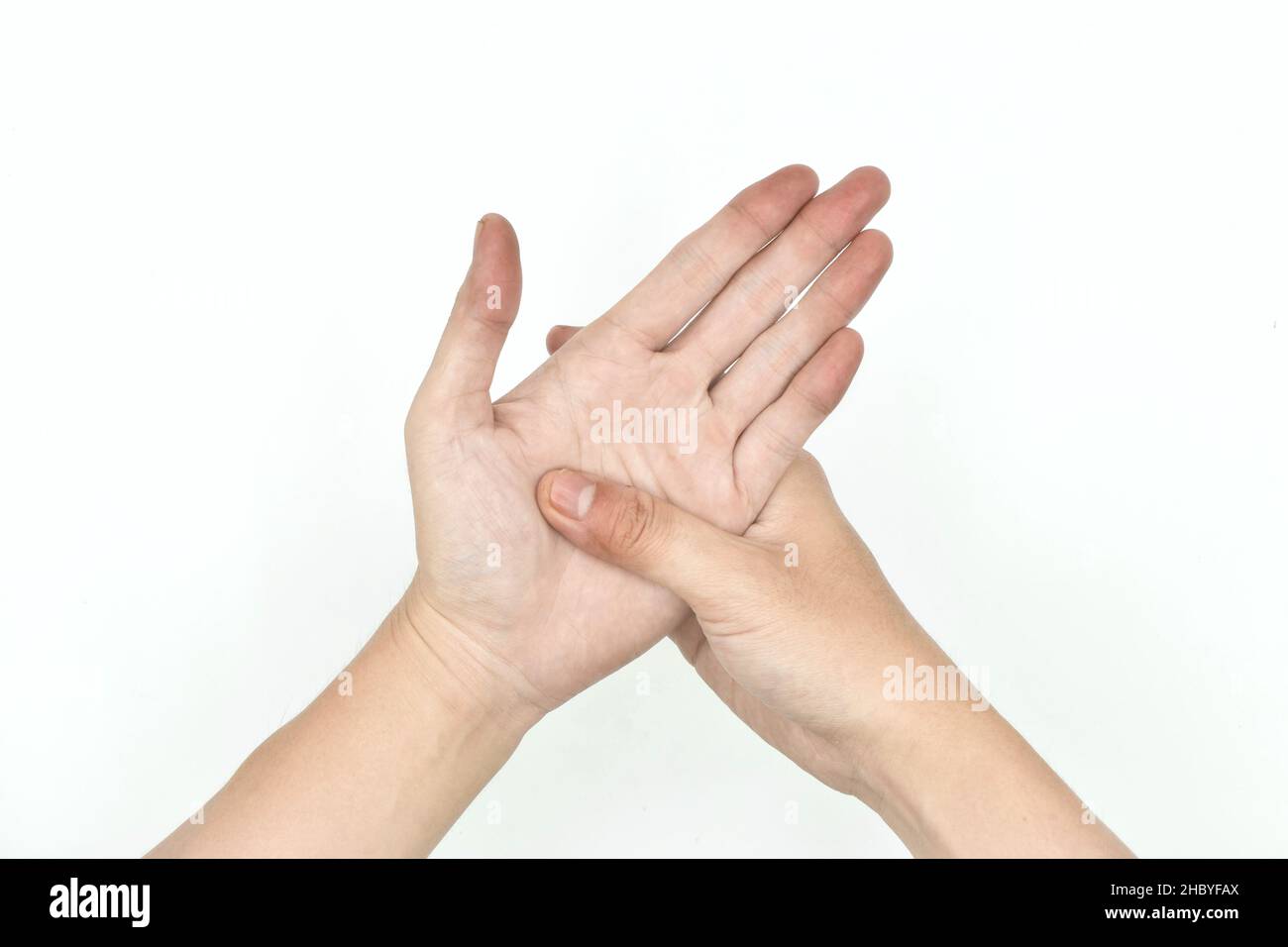 Cyanotic hands or peripheral cyanosis or blue hands at Southeast Asian ...