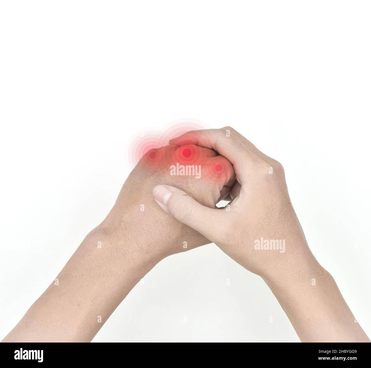 Metacarpophalangeal joints hi-res stock photography and images - Alamy