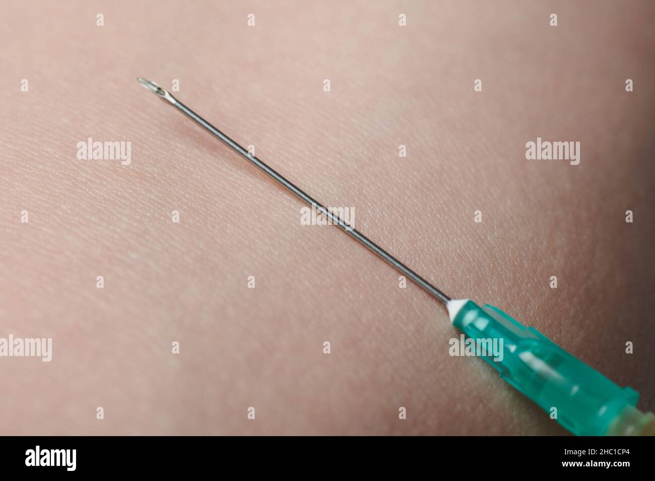 Medicine syringe needle macro close up view on human skin background ...