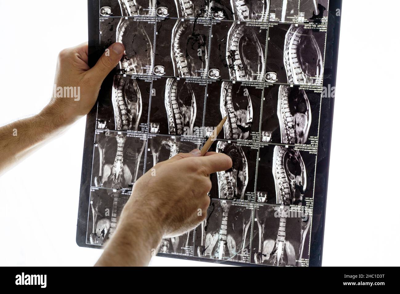 Doctor holding chest x ray hi-res stock photography and images - Alamy