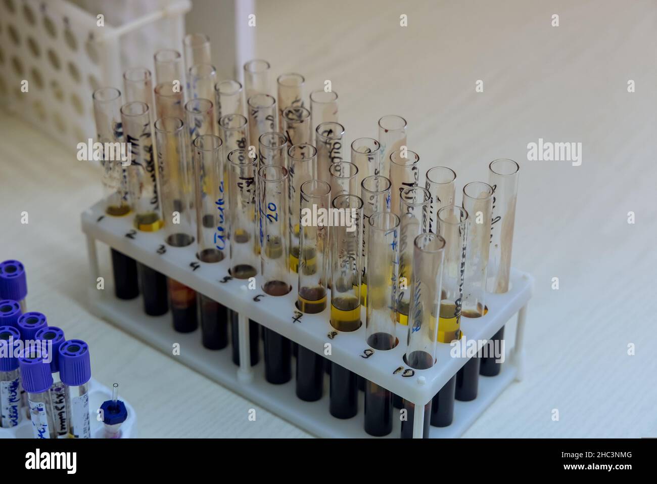 Medical equipment blood sample tube from a rack with analysis in the ...