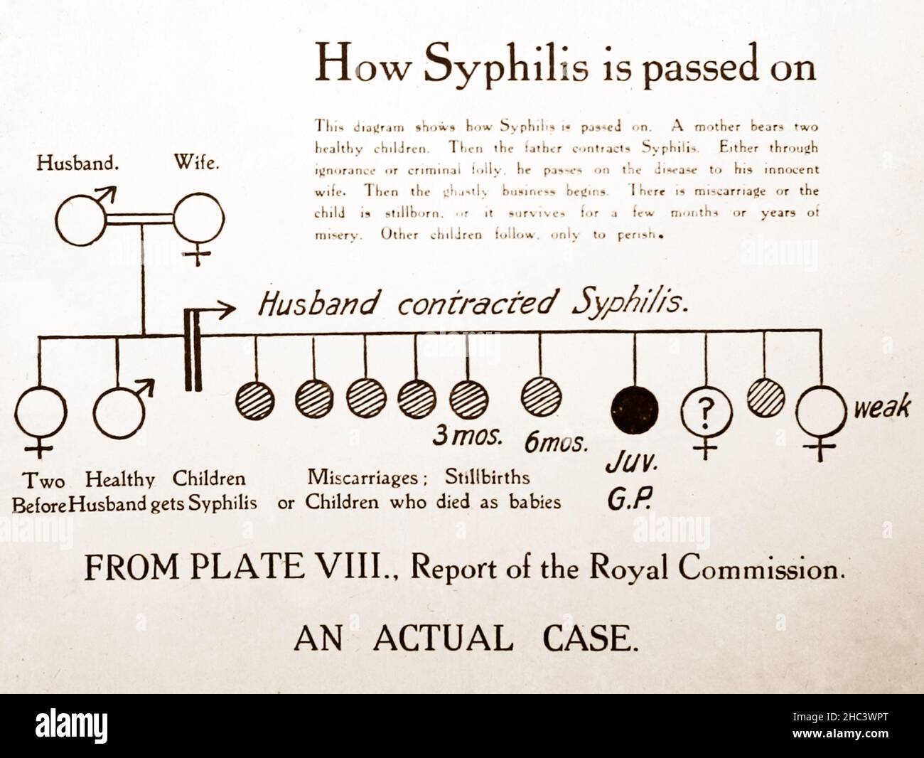 How syphilis is passed on, 1920s projection slide Stock Photo - Alamy