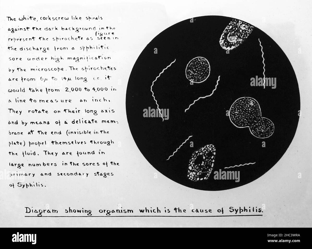 The Syphilis organism, 1920s projection slide Stock Photo - Alamy