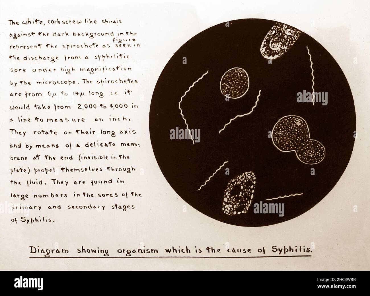 The Syphilis organism, 1920s projection slide Stock Photo - Alamy