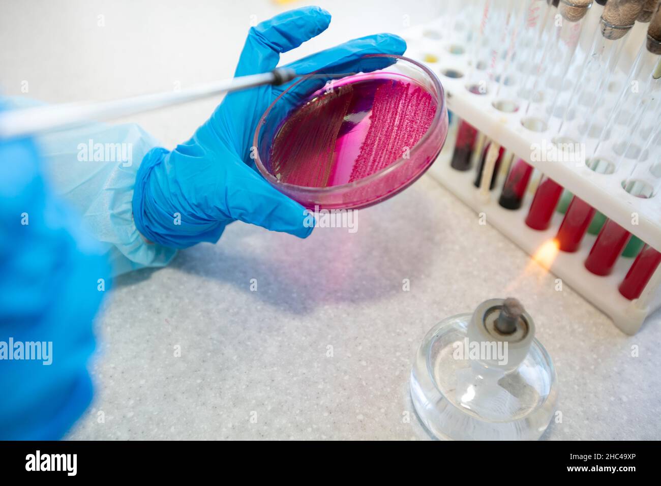 The hands of a physician laboratory assistant in an infectious disease ...