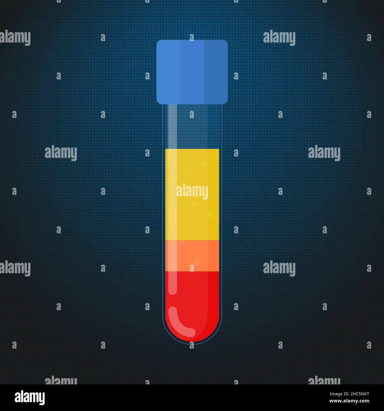 Blood plasma fractionation hi-res stock photography and images - Alamy