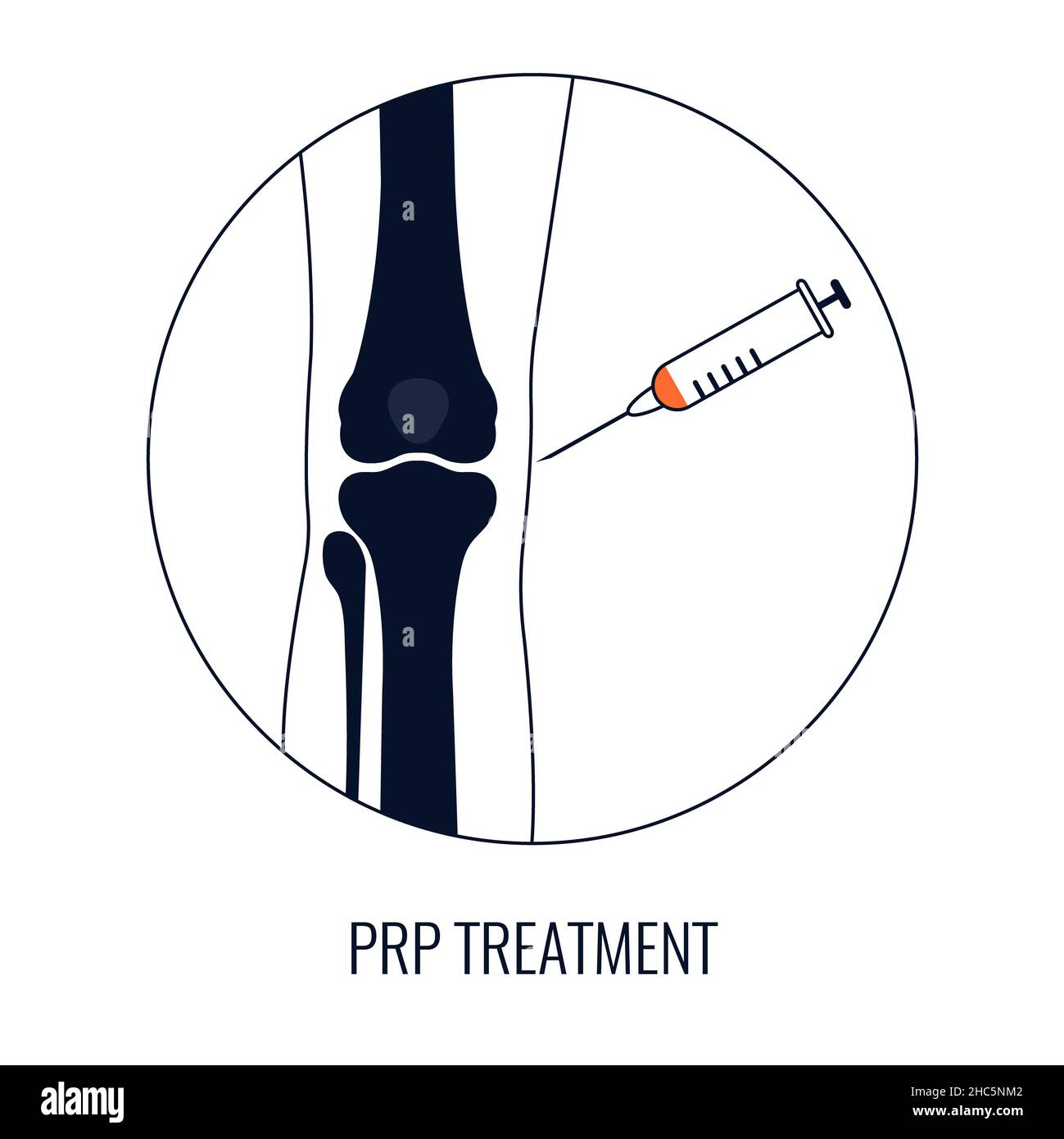 Knee joint injection treatment, conceptual illustration Stock Photo - Alamy