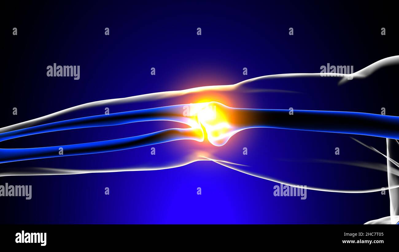 Elbow joint pain Anatomy For Medical Concept 3D Illustration Stock ...
