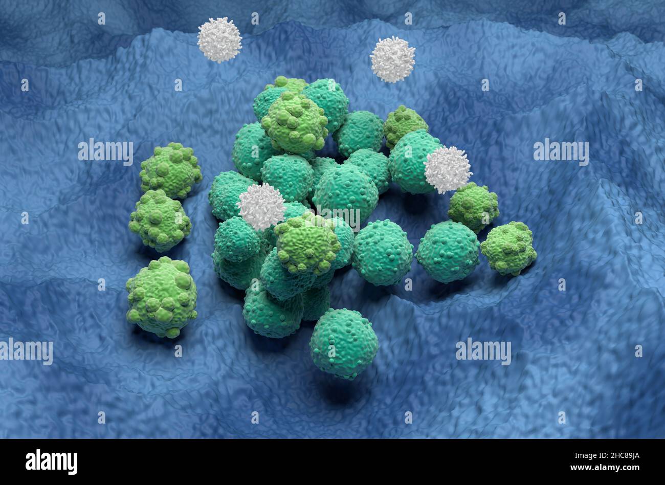 T-cells attack lymphoma leukemia blood cancer cells 3d render ...