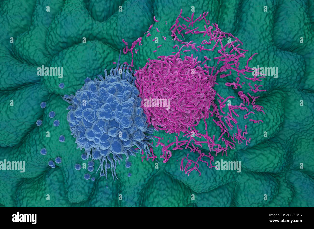 Gastric stomach cancer cells top view 3d illustration Stock Photo - Alamy