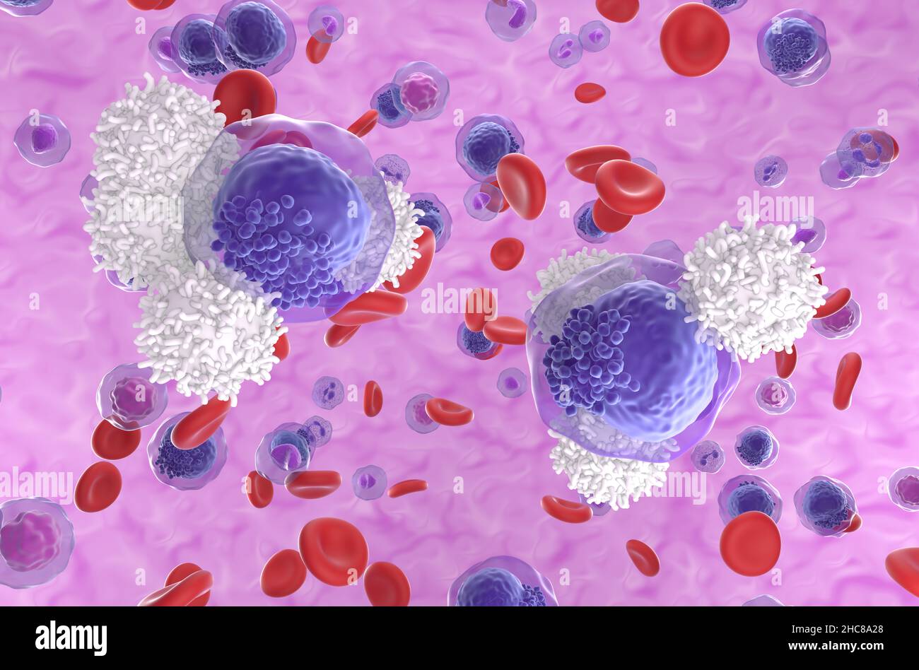 T-cells attack acute myeloid leukemia (AML) cells in blood flow ...