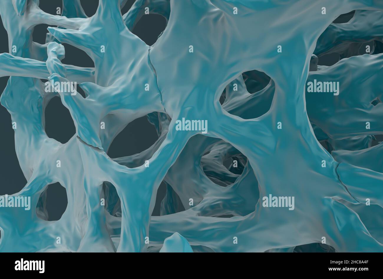 Fracture bones in osteoporosis - isometric right view 3d illustration ...