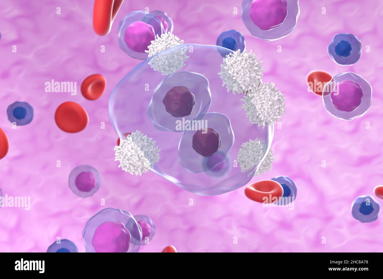 Reed-Sternberg cell in hodgkin lymphoma attacked by t-cells isometric ...