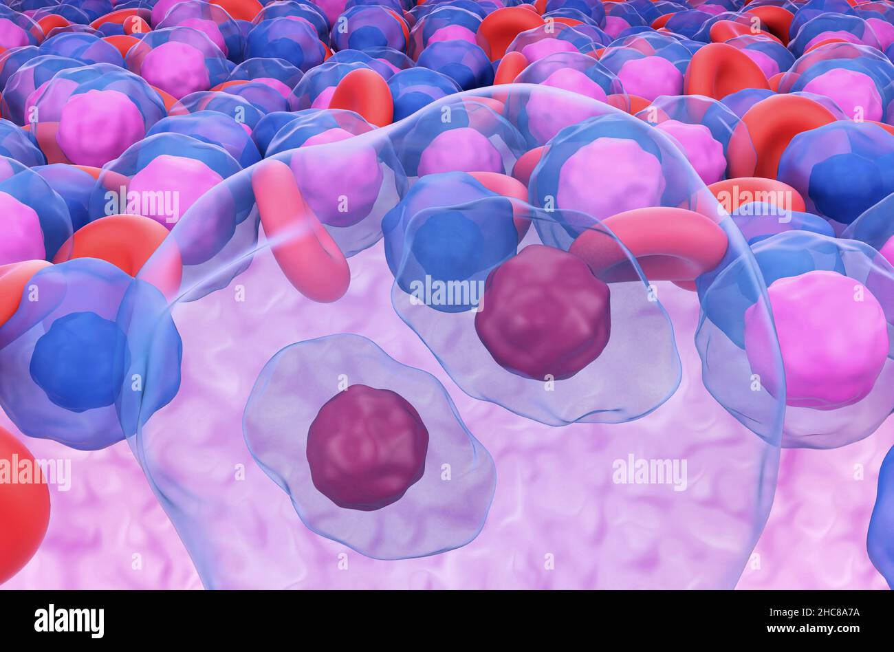 Reed-Sternberg cell in hodgkin lymphoma closeup view 3d render ...