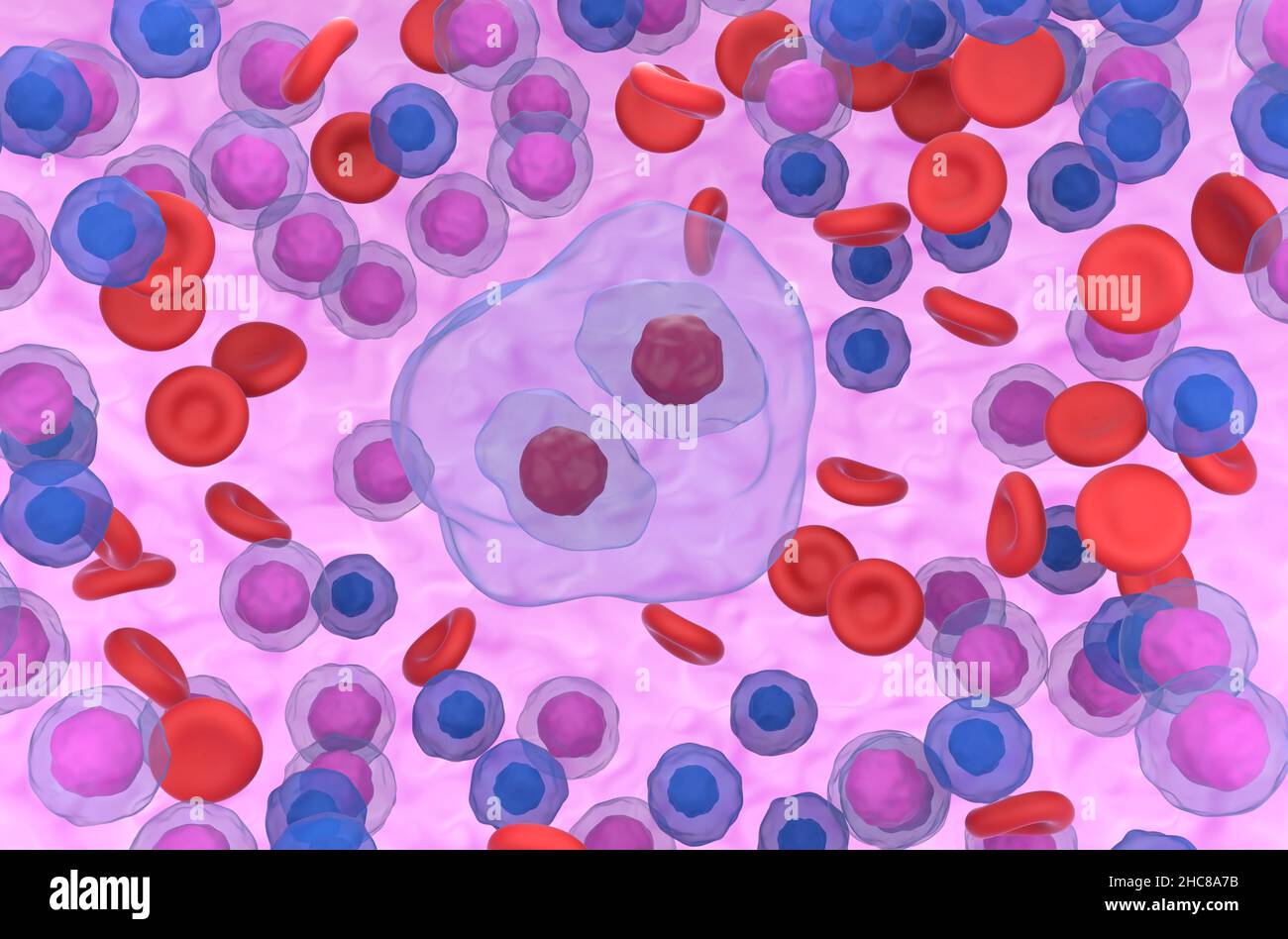 Reed-Sternberg cell in hodgkin lymphoma front view 3d render ...