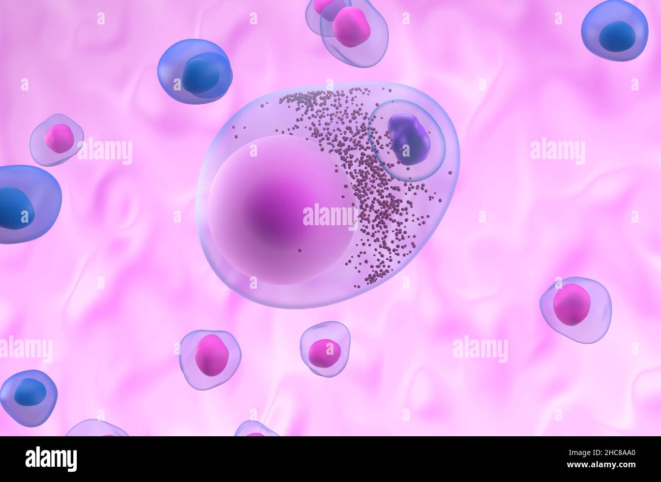 Lewy body in parkinson's disease (PD) or dementia (LBD) - closeup 3d ...