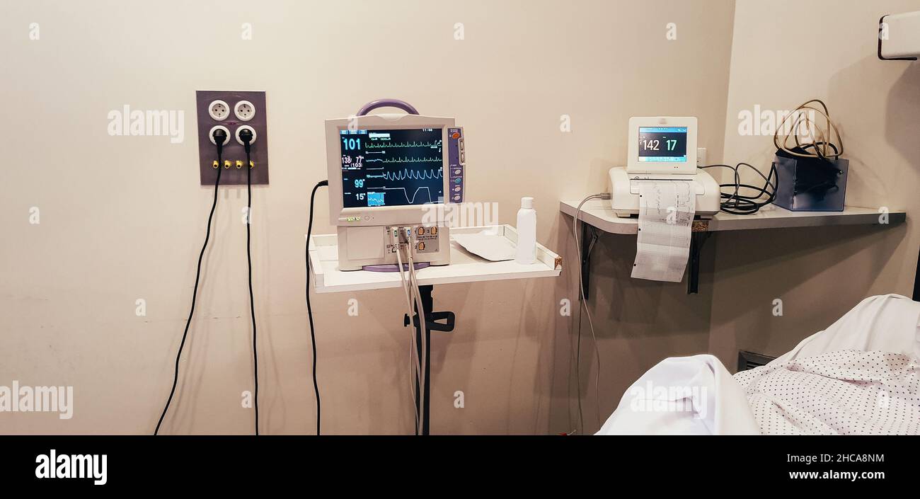 Cardiogram report printing from Electrocardiograph. For baby's health ...