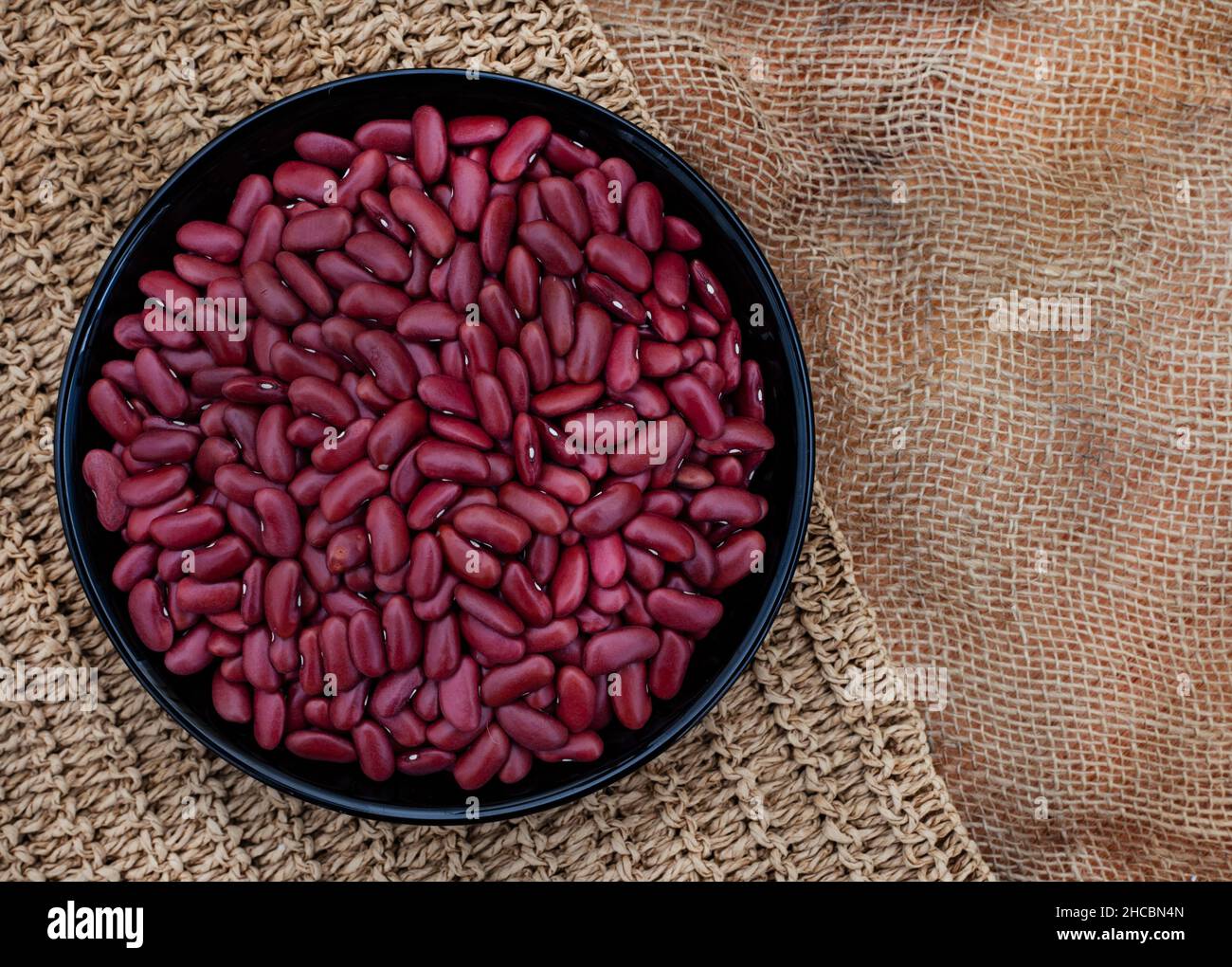 Kidney word hi-res stock photography and images - Alamy