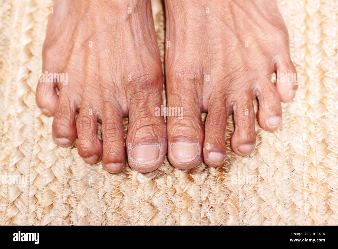 top view of senior women feet on floor Stock Photo - Alamy