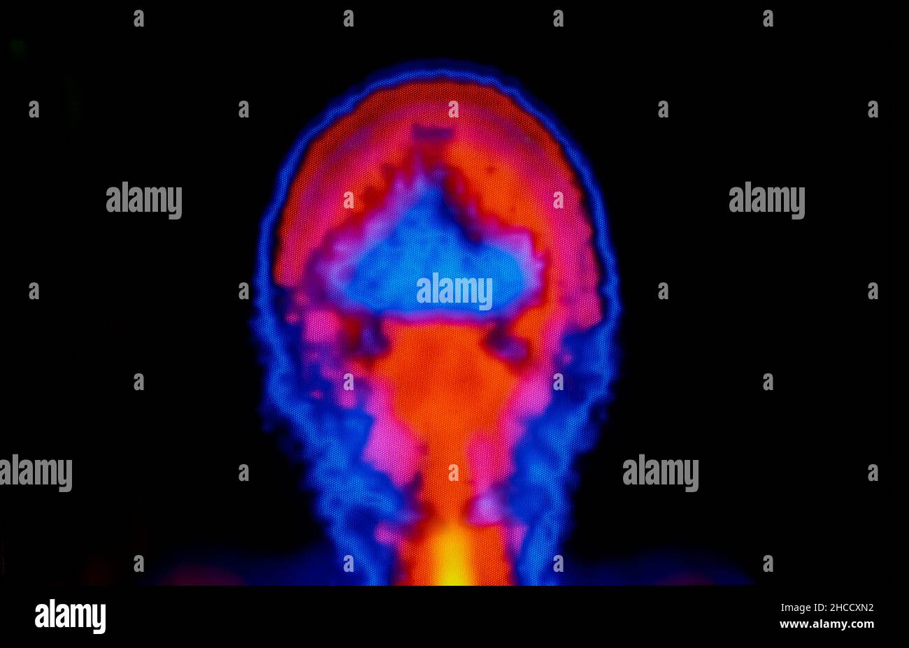 image scan of skull Stock Photo - Alamy