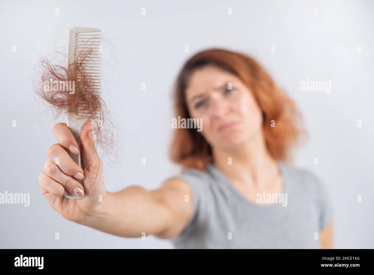 Cancer Alopecia High Resolution Stock Photography and Images - Alamy